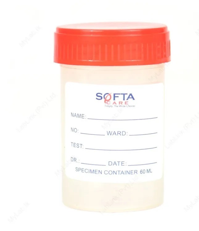 Sterile Urine Sample Collection Container Bottle 60ml | TRUECARE MARKETING